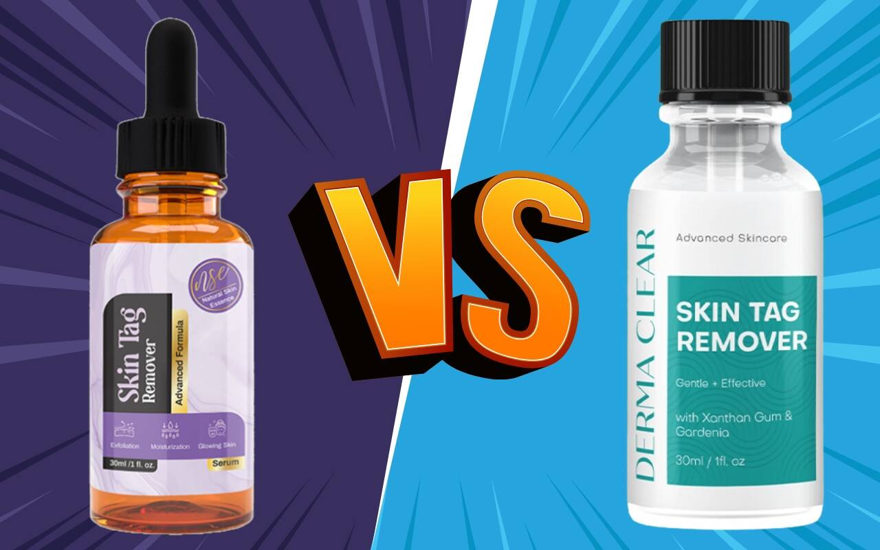 Natural Skin Essence Skin Tag Remover vs Derma Clear Skin Tag Remover ...